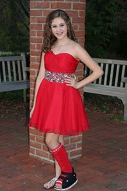 6 Ways to Complete Your Prom or Wedding Look (while injured)