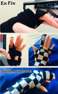 External Fixators, Ex-Fixes, and Halo's: Custom Covers to Help You Heal!