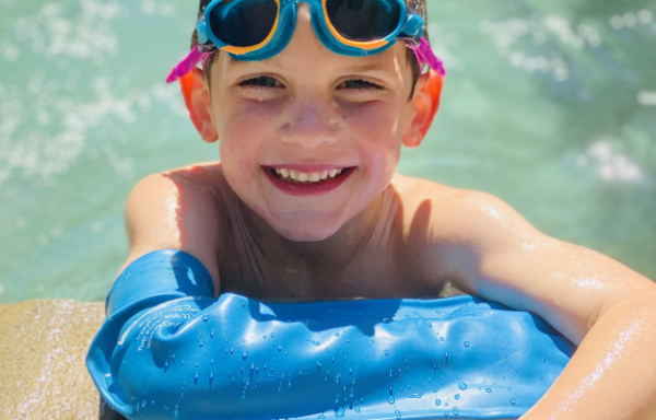 Why Is It Important to Keep Your Cast Dry?