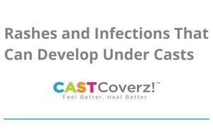 Rashes and Infections That Can Develop Under Casts